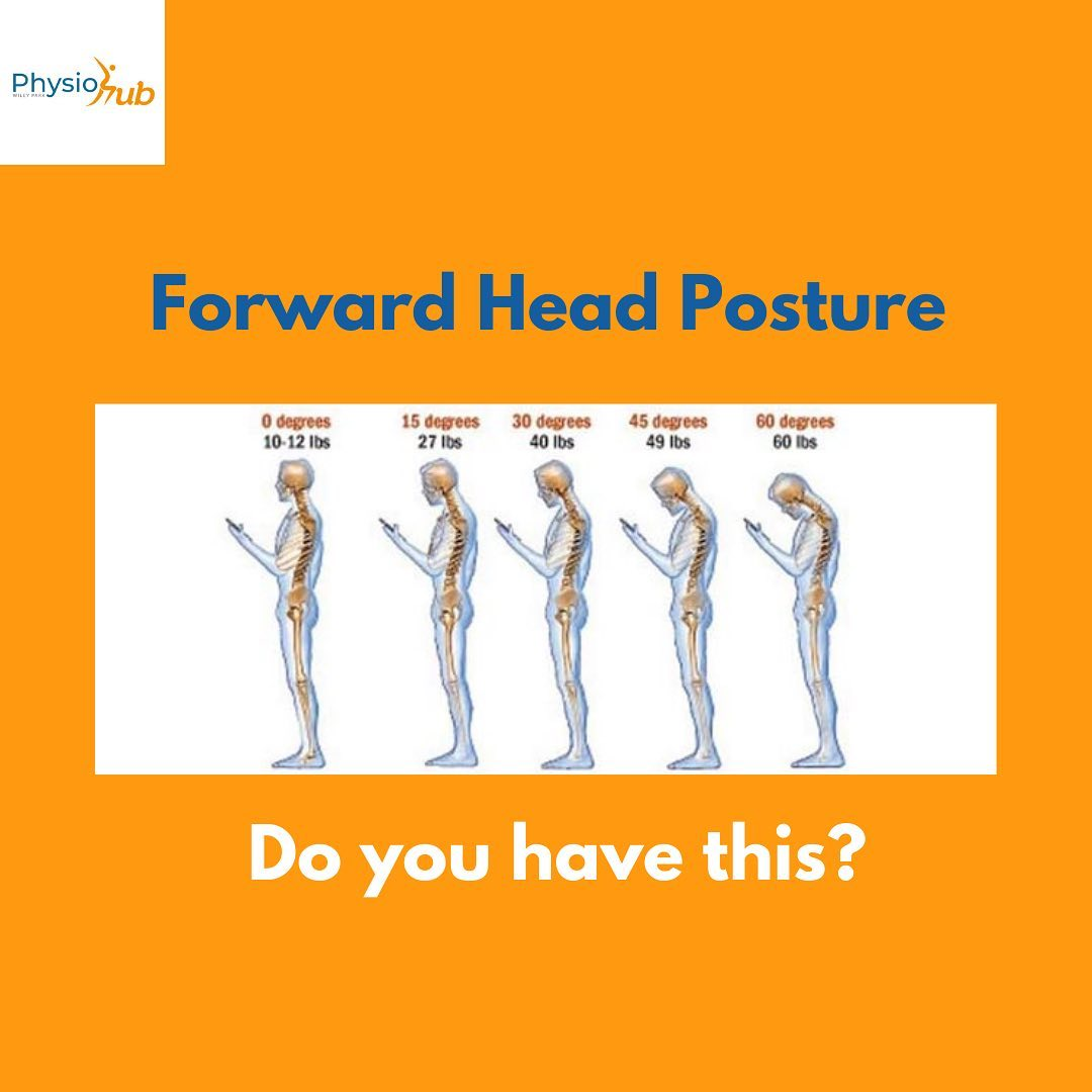 Forward Head Posture – PhysioHub Wiley Park